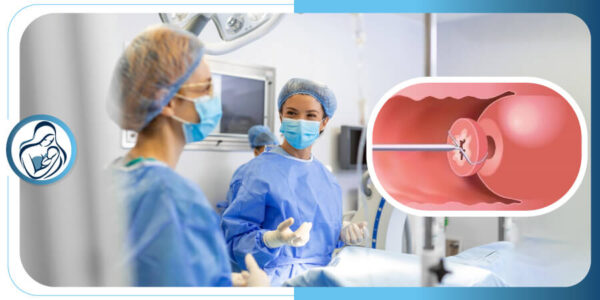 Cirugía de Cuello de Útero (Cono Leep) – Dra. Mónica Medina ...